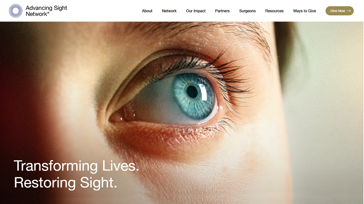 Precision Ocular Biobank - Advancing Sight Network